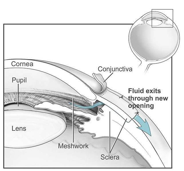 Principles of Glaucoma - PREP Duke Elder