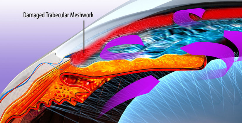 Principles of Glaucoma - PREP Duke Elder