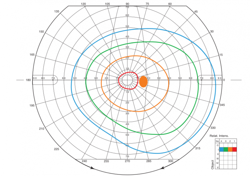 Principles of Neuro-Ophthalmology - PREP Duke Elder