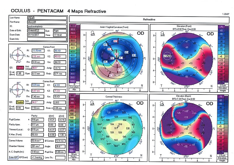 Principles of the Cornea - PREP Duke Elder