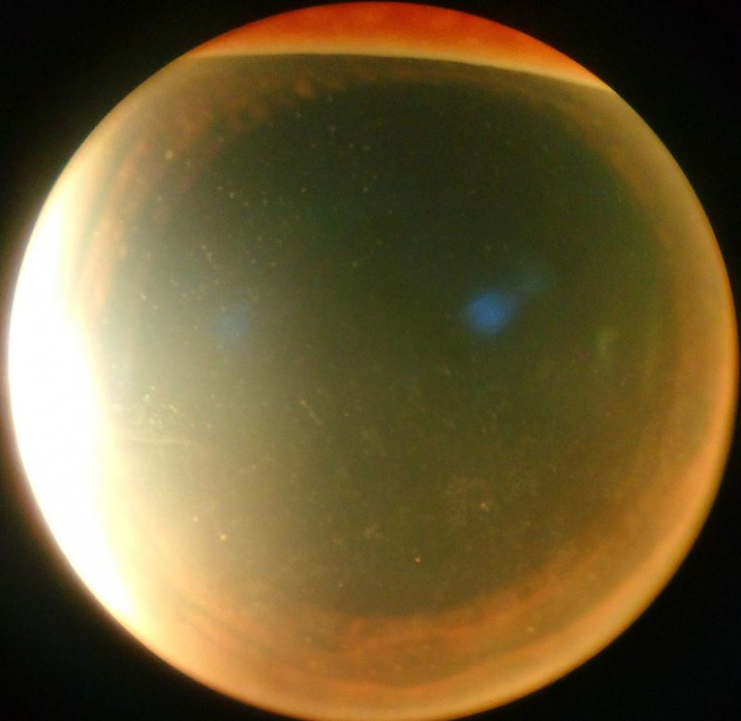 Principles of Optics and Refraction - PREP Duke Elder