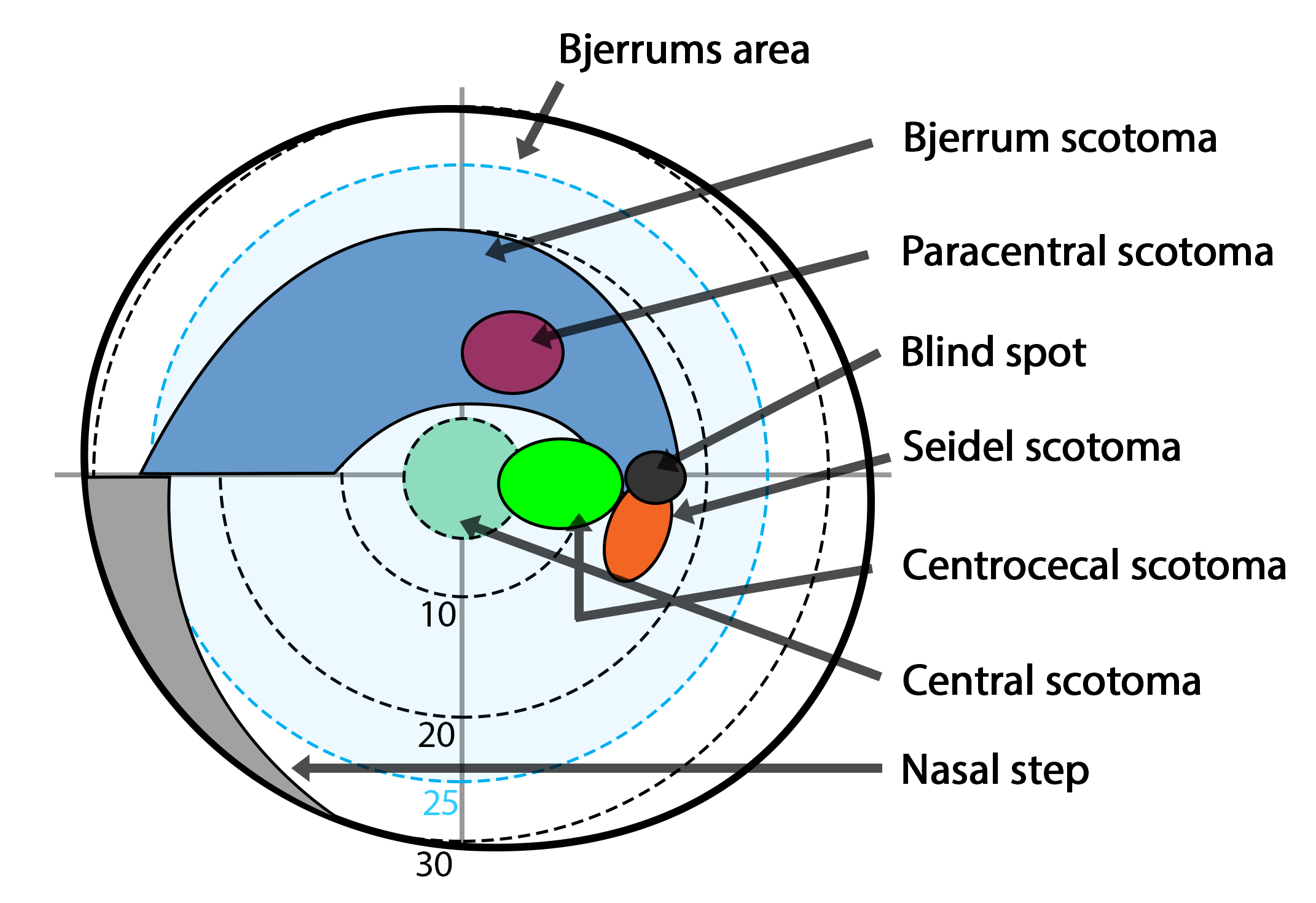 Principles of Neuro-Ophthalmology - PREP Duke Elder