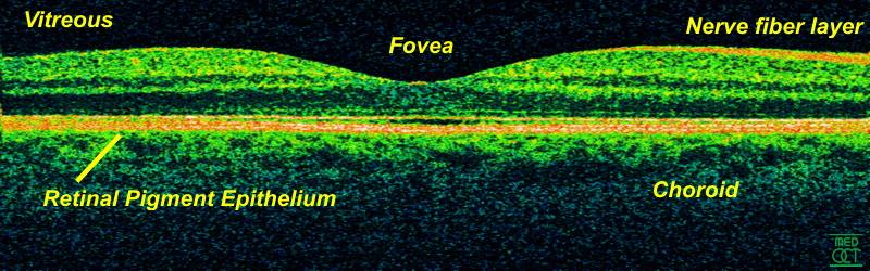 Principles of the Retina and Vitreous - PREP Duke Elder