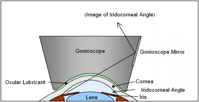 Principles of Optics and Refraction - PREP Duke Elder